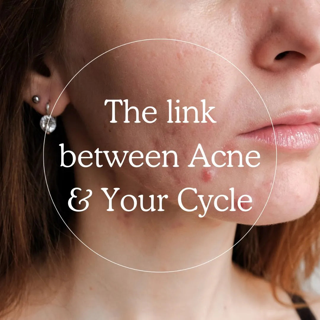 What’s the deal with hormonal acne? – Myoovi
